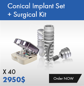 MSDI dental Implants