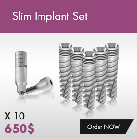 MSDI dental Implants