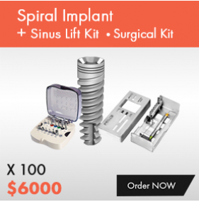 MSDI dental Implants