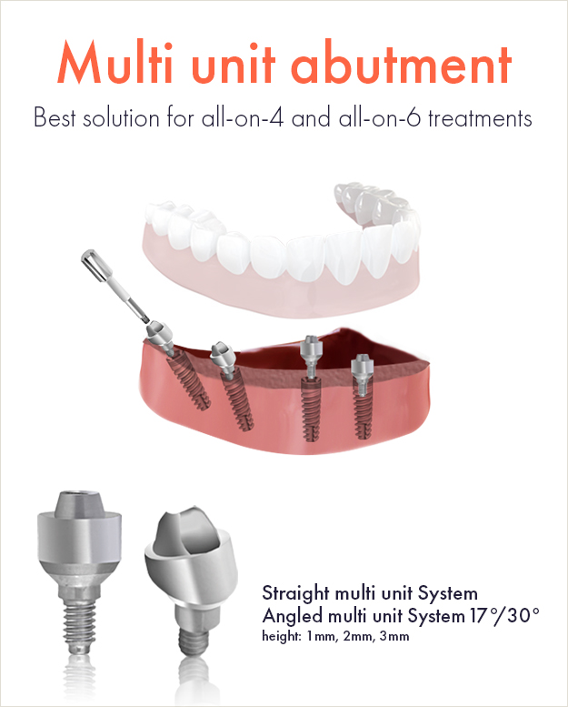 MSDI dental Implants
